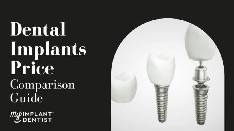 Dental Implants Price Comparison Guide - My Implant Dentist