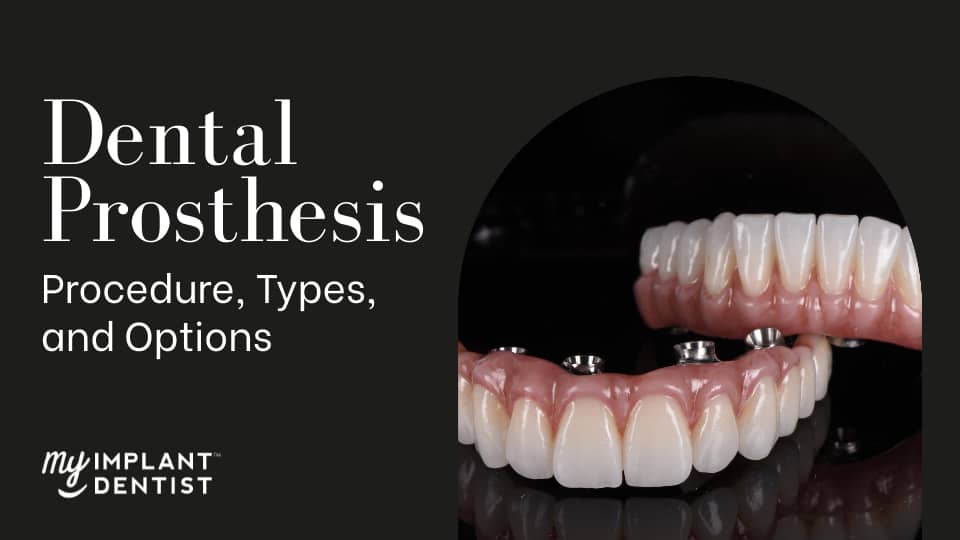 Dental Prosthesis - Procedure, Types & Options